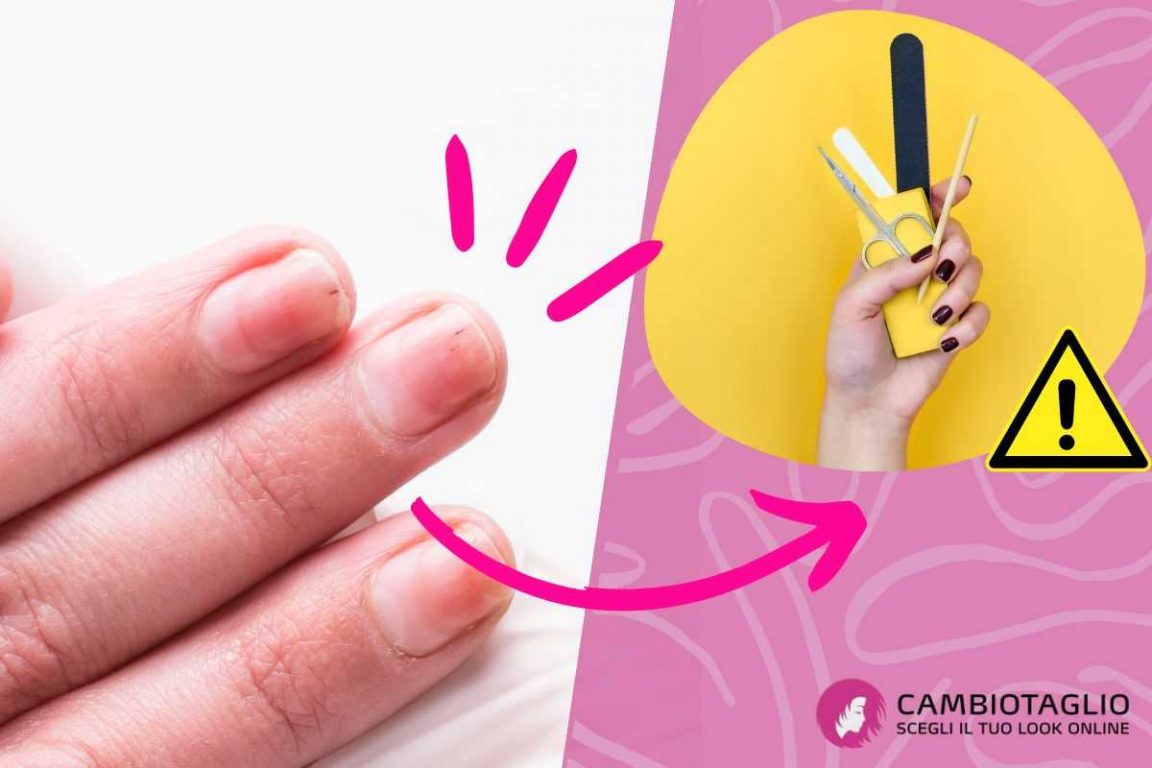 Unghie deboli dopo la rimozione del gel? Ecco come trattarle in 5 ...